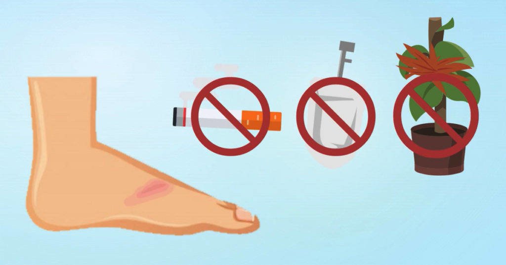 Incontri pericolosi in mare: tracina o pesce ragno - Med4Care