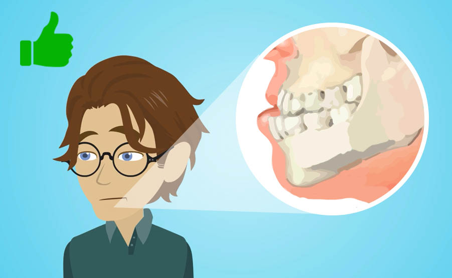 Criteri di El-Ganzouri per identificare la difficoltà all'intubazione ...