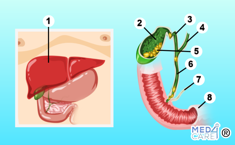 Colica biliare: dolore da ostruzione delle vie biliari - Med4Care
