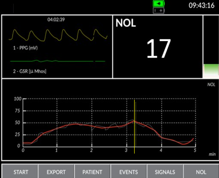 NOL: indice multiparametrico per la misura del dolore - Med4Care