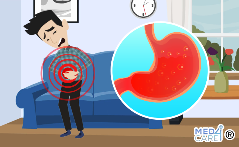 Dispepsia: cause sintomi e trattamenti della cattiva digestione - Med4Care