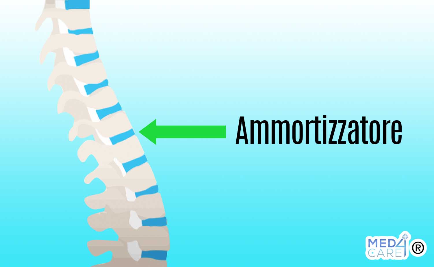 Degenerazione discale - Med4Care