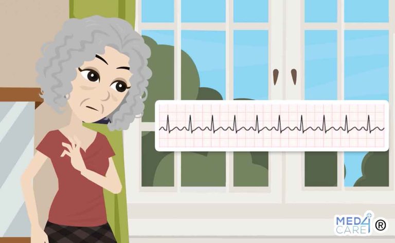 Aritmia sinusale - Med4Care