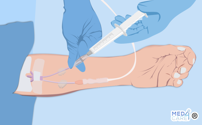 Iniezione endovenosa - Med4Care