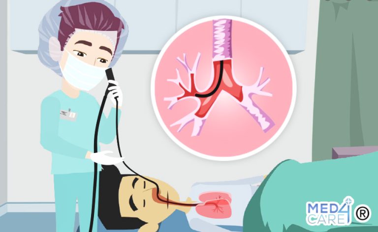 Fibrobroncoscopia - Med4Care
