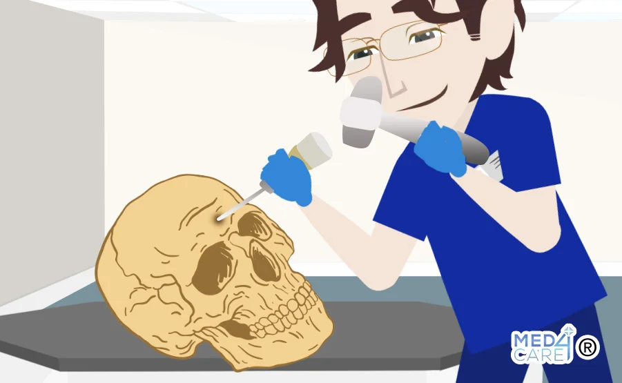 Lobotomia Lobotomy | Definition, Procedure, History, Effects, & Facts