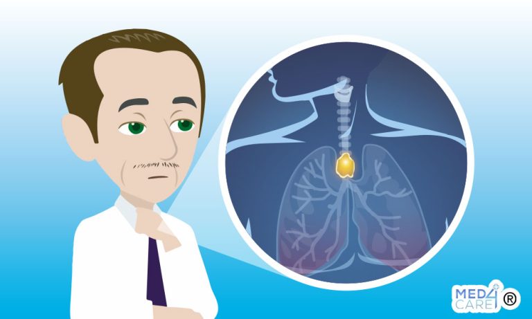 Cosa comporta la rimozione del timo in età adulta? - Med4Care